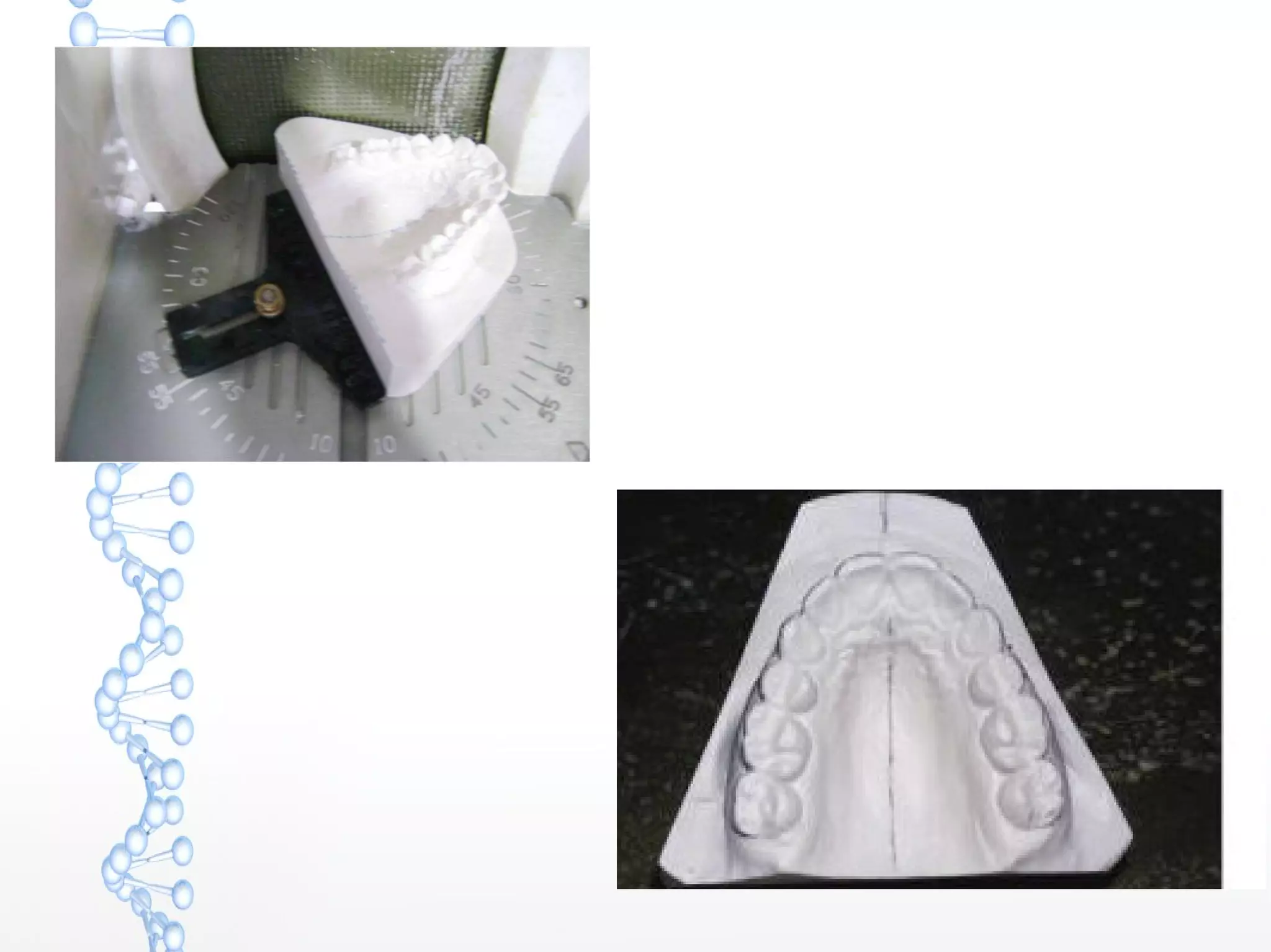 BASING AND TRIMMING OF ORTHODONTIC MODELS | ODP