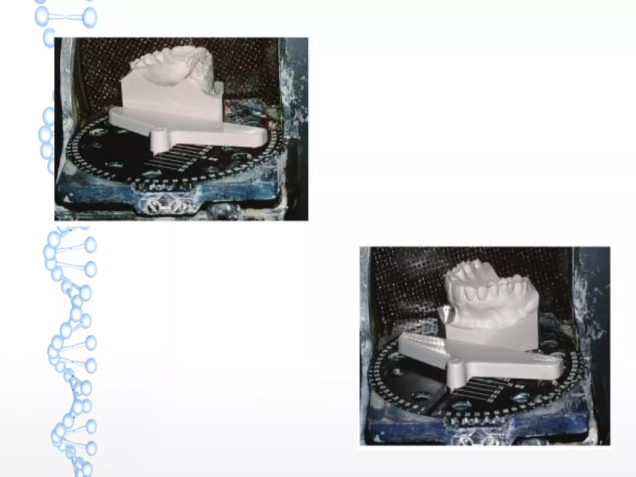 BASING AND TRIMMING OF ORTHODONTIC MODELS | ODP