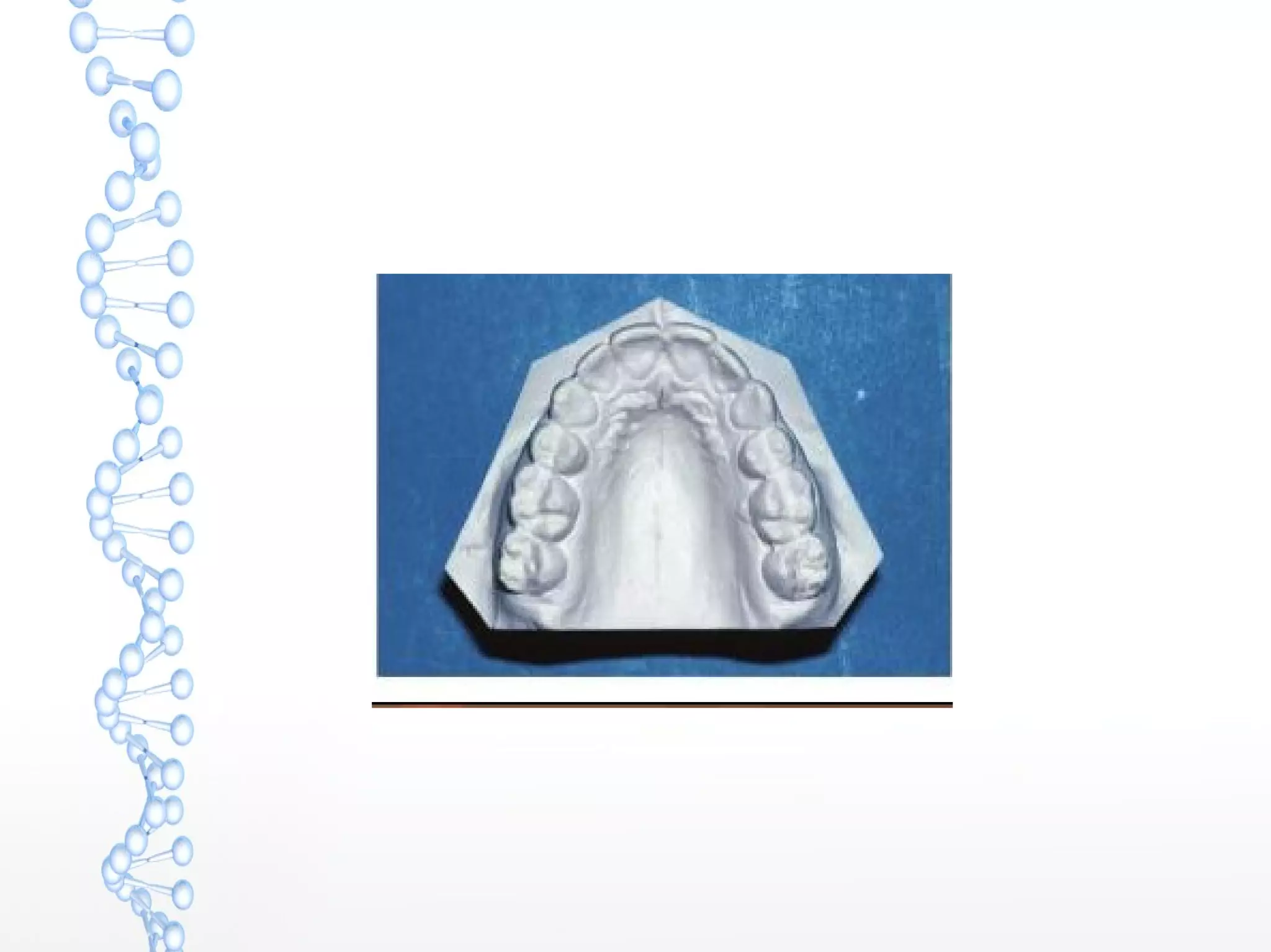 BASING AND TRIMMING OF ORTHODONTIC MODELS | ODP