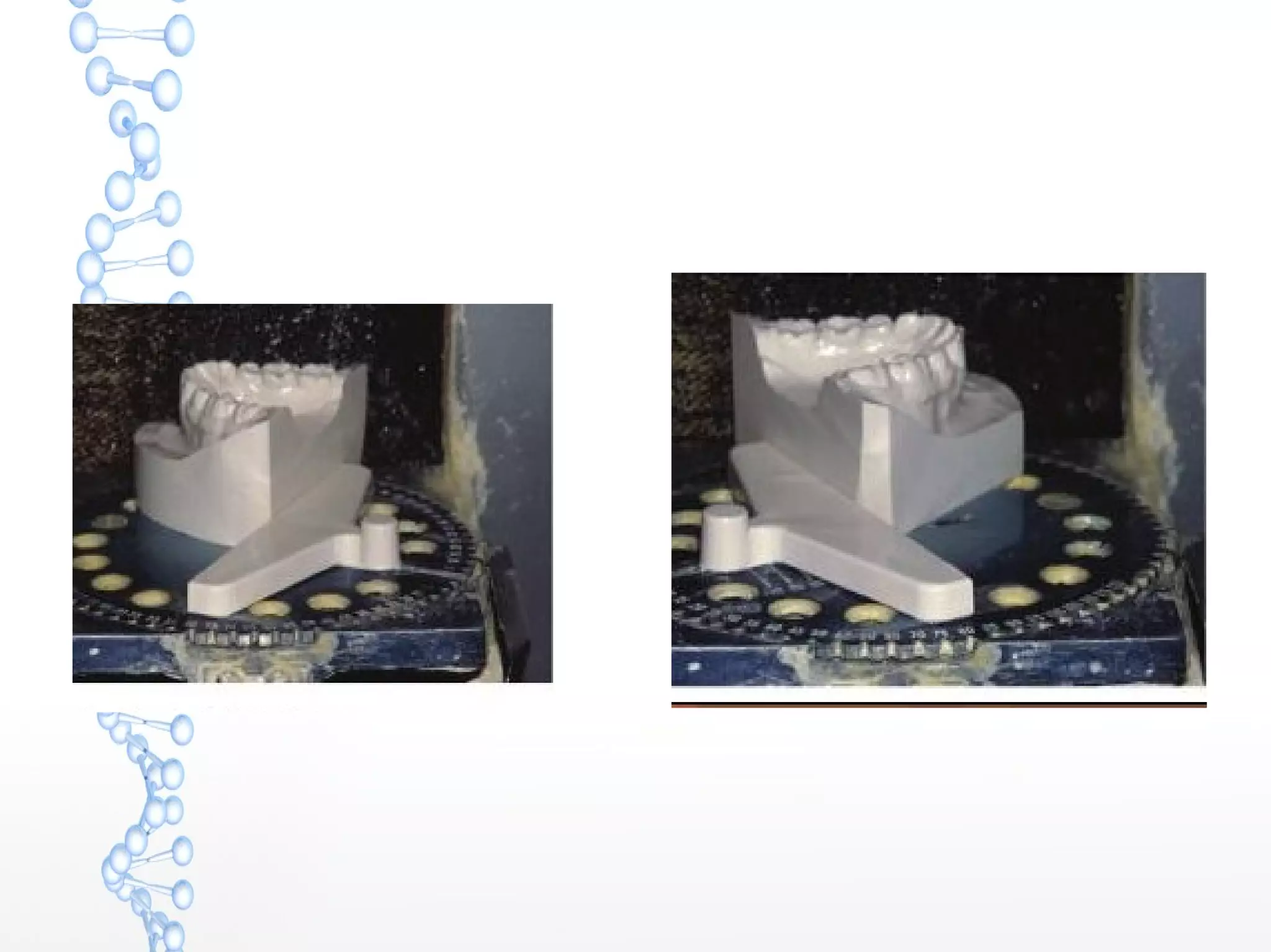 BASING AND TRIMMING OF ORTHODONTIC MODELS | ODP