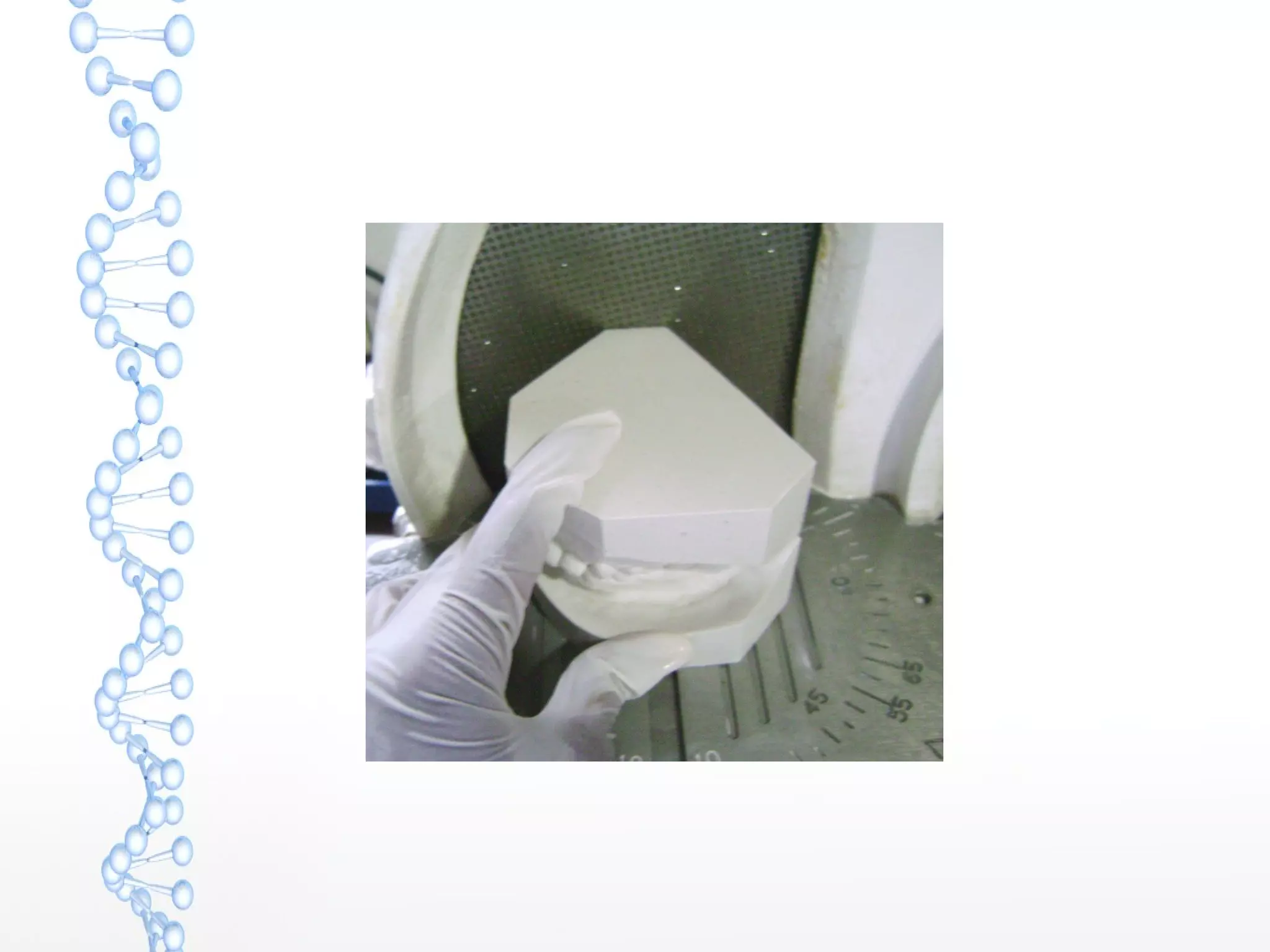 BASING AND TRIMMING OF ORTHODONTIC MODELS | ODP