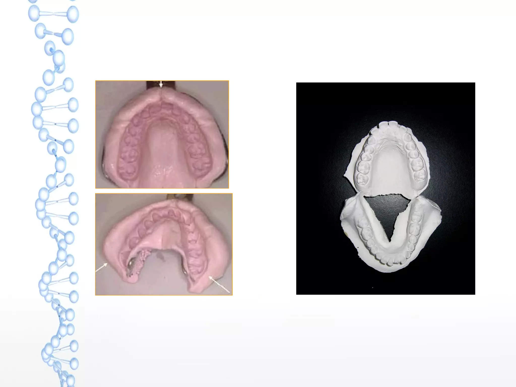 BASING AND TRIMMING OF ORTHODONTIC MODELS | ODP