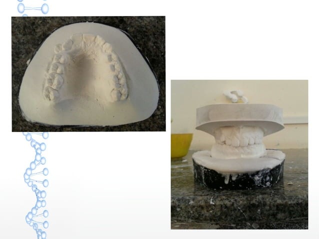 BASING AND TRIMMING OF ORTHODONTIC MODELS | ODP