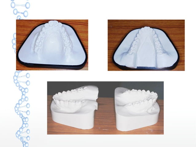 BASING AND TRIMMING OF ORTHODONTIC MODELS | ODP