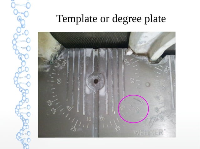 BASING AND TRIMMING OF ORTHODONTIC MODELS | ODP