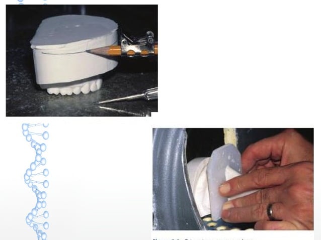 BASING AND TRIMMING OF ORTHODONTIC MODELS | ODP