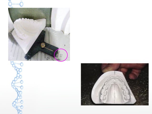 BASING AND TRIMMING OF ORTHODONTIC MODELS | ODP