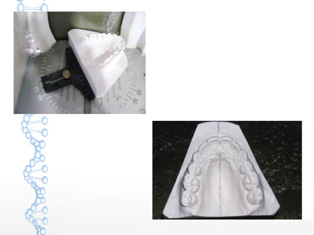 BASING AND TRIMMING OF ORTHODONTIC MODELS | ODP