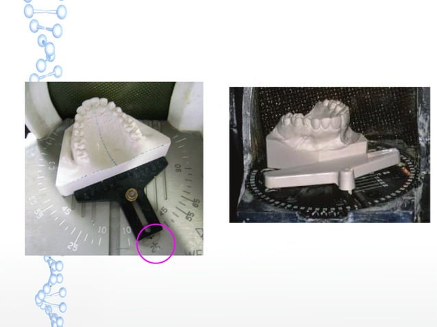 BASING AND TRIMMING OF ORTHODONTIC MODELS | ODP