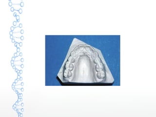 BASING AND TRIMMING OF ORTHODONTIC MODELS | ODP