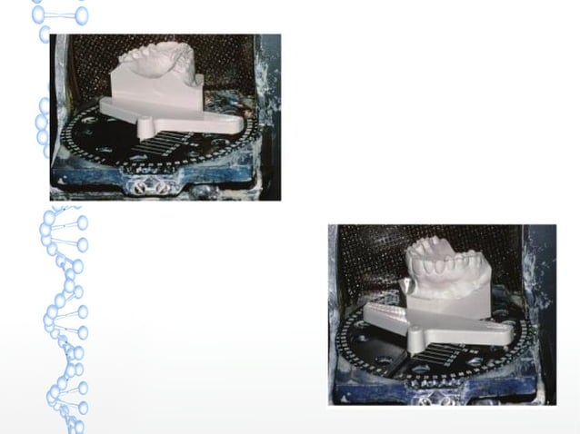 BASING AND TRIMMING OF ORTHODONTIC MODELS | ODP