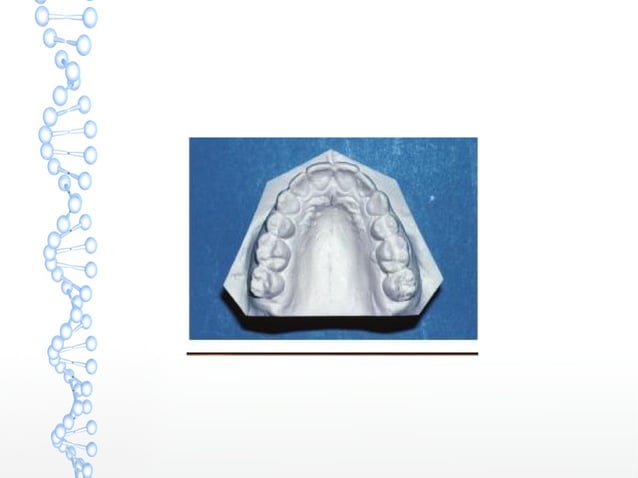 BASING AND TRIMMING OF ORTHODONTIC MODELS | ODP