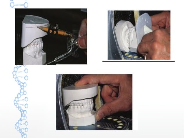 BASING AND TRIMMING OF ORTHODONTIC MODELS | ODP