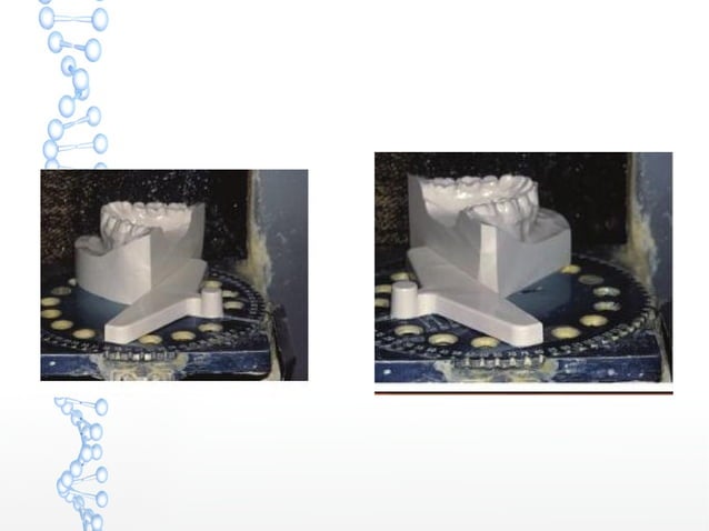 BASING AND TRIMMING OF ORTHODONTIC MODELS | ODP