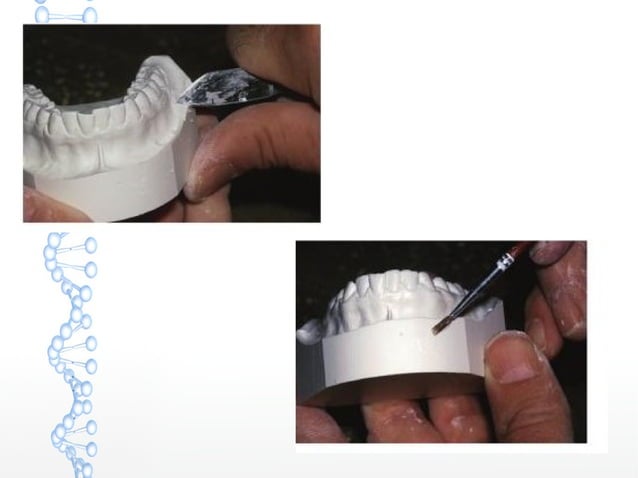 BASING AND TRIMMING OF ORTHODONTIC MODELS | ODP