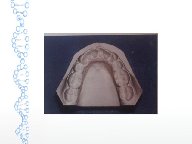 BASING AND TRIMMING OF ORTHODONTIC MODELS | ODP