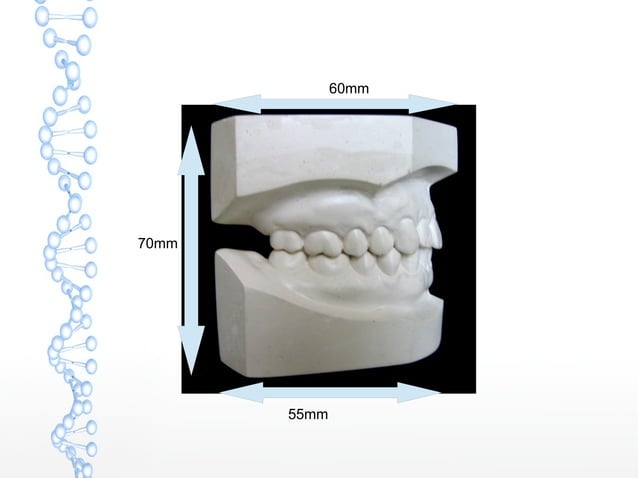 BASING AND TRIMMING OF ORTHODONTIC MODELS | ODP