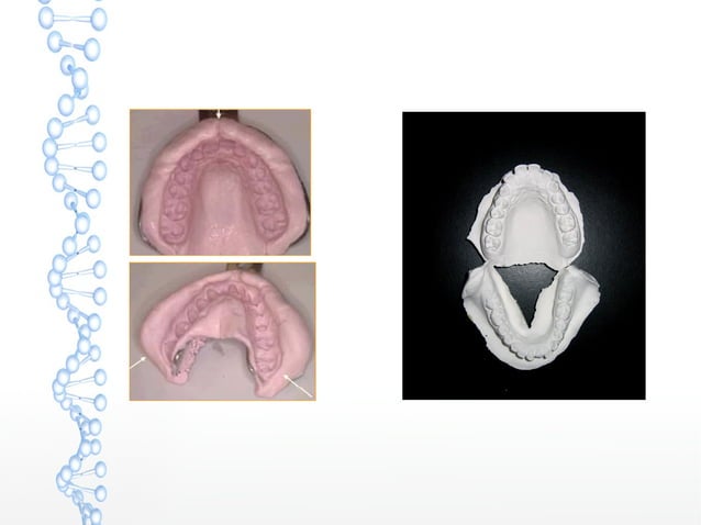 BASING AND TRIMMING OF ORTHODONTIC MODELS | ODP