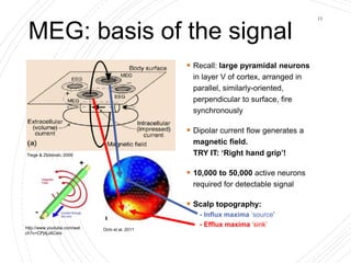Basis_MEEG_signal_LiS2 Basis_MEEG_signal_LiS2.ppt | Brain and Nervous ...