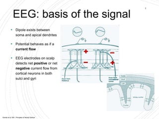Basis_MEEG_signal_LiS2 Basis_MEEG_signal_LiS2.ppt | Brain and Nervous ...