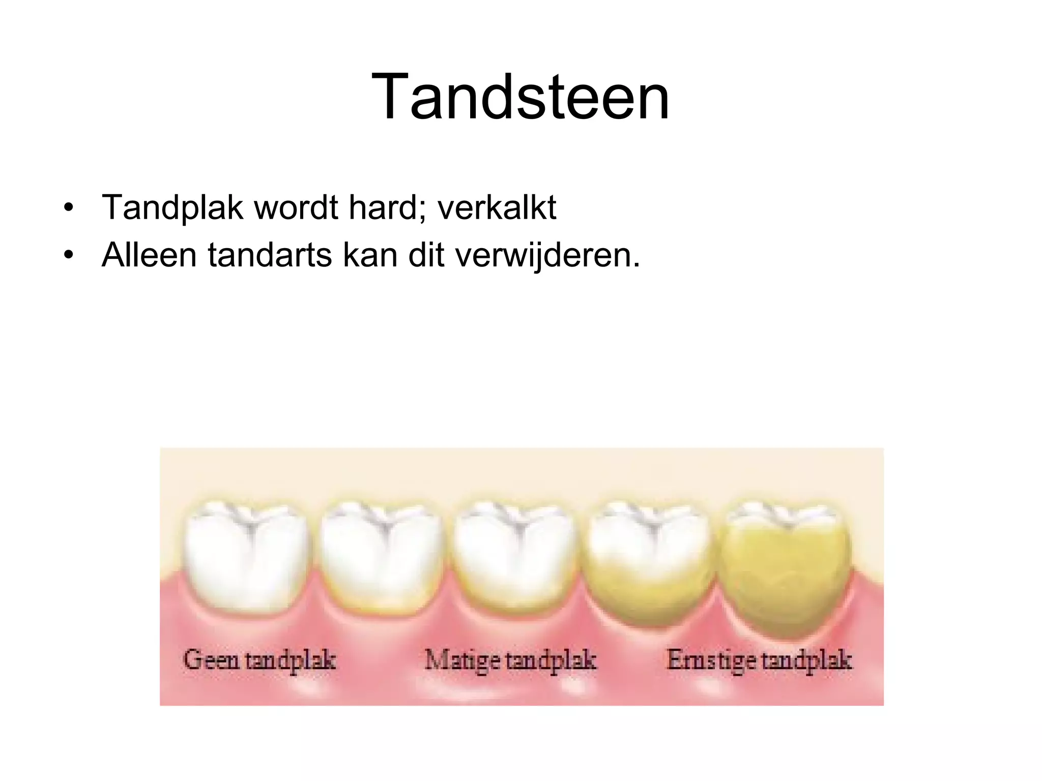 Basisstof 6, het gebit | PPT