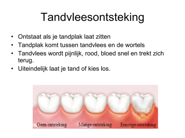 Basisstof 6, het gebit | PPT