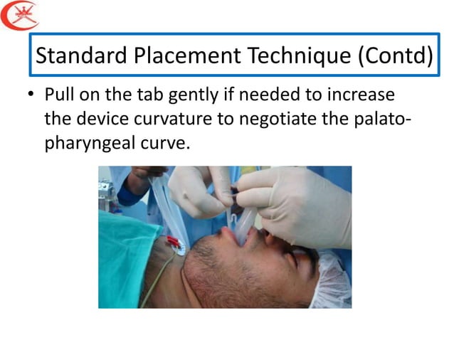 Baska mask | PPTX | Ear, Nose and Throat Conditions | Diseases and ...