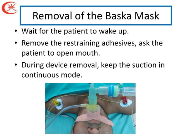 Baska mask | PPTX | Ear, Nose and Throat Conditions | Diseases and ...