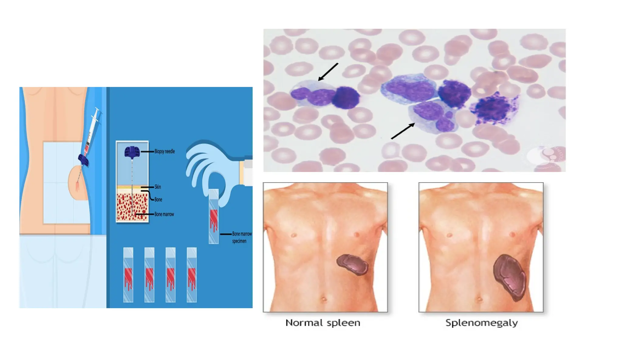 BASOPHILIA immune system presentation 12 | PPTX