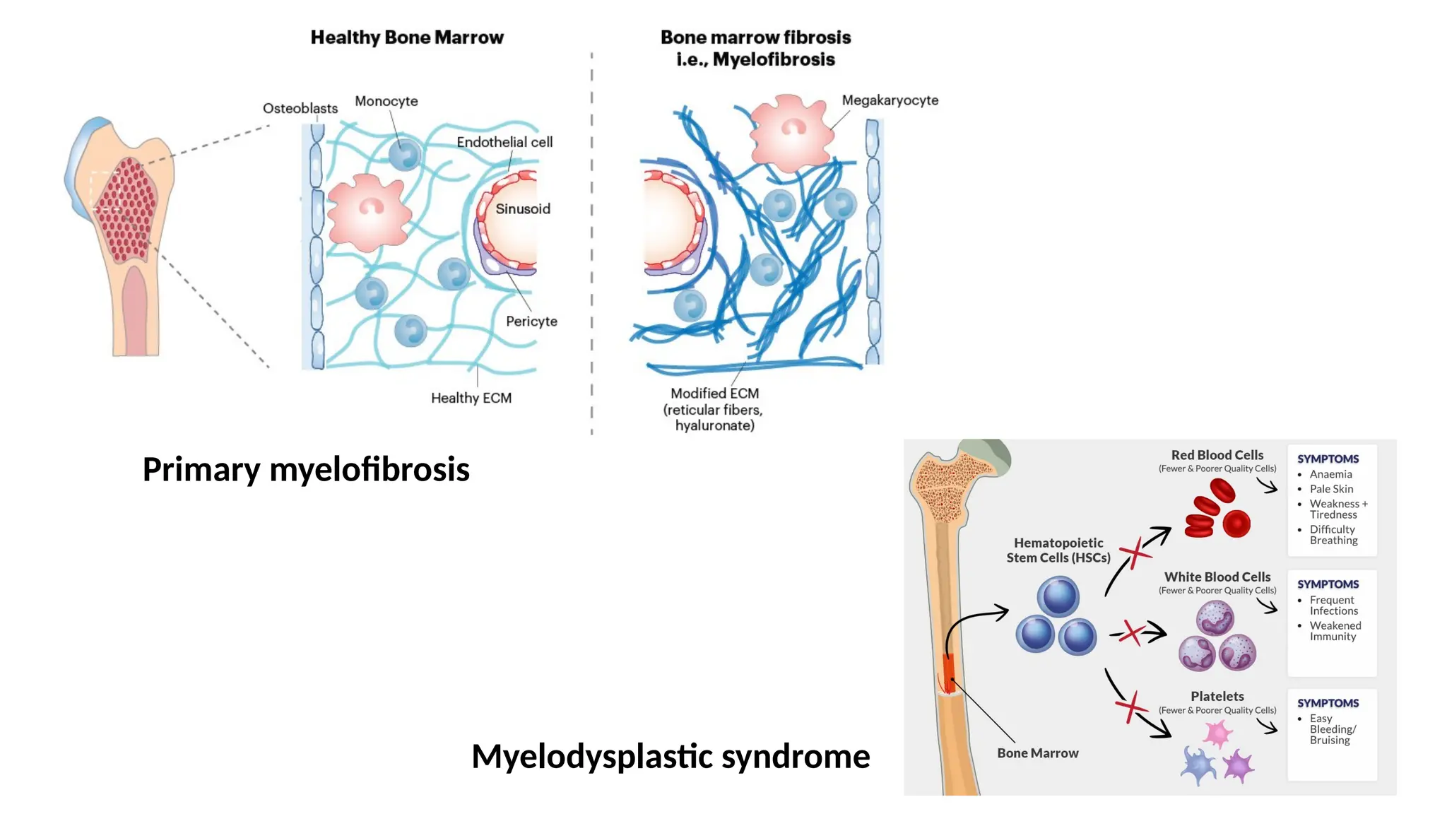 BASOPHILIA immune system presentation pp | PPTX