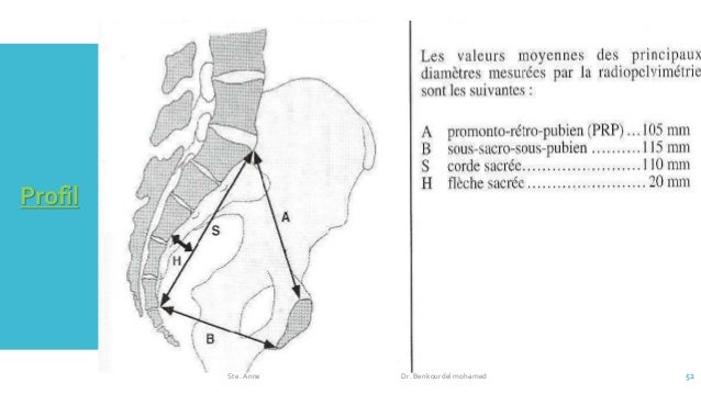 Bassin obstetrical [enregistrement automatique]