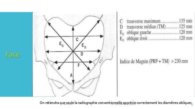 Bassin obstetrical [enregistrement automatique]