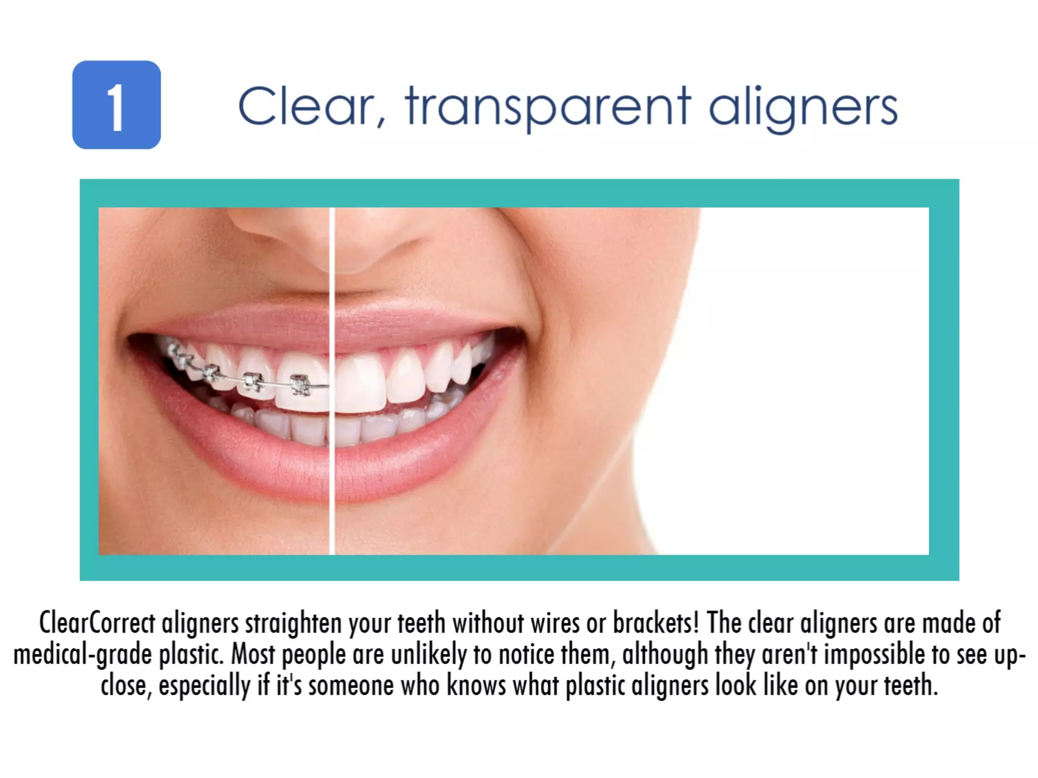 8 Facts About ClearCorrect Orthodontics | PDF