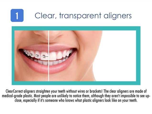 8 Facts About ClearCorrect Orthodontics | PDF