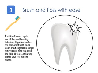 8 Facts About ClearCorrect Orthodontics | PDF