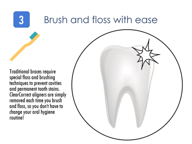 8 Facts About ClearCorrect Orthodontics | PDF