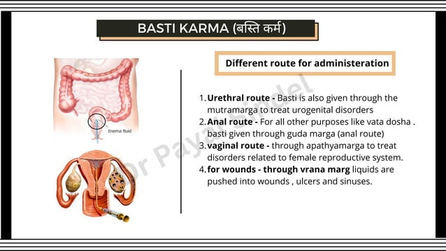 Basti - Panchkarma | PDF