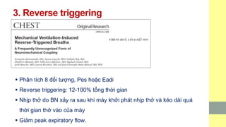 bất đồng bộ bệnh nhân và máy thở | PDF