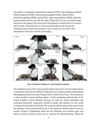 BATCH 4 DESIGN OF OPTICAL SYSTEM FOR SMART PHONE BASED FUNDUS CAMERA ...