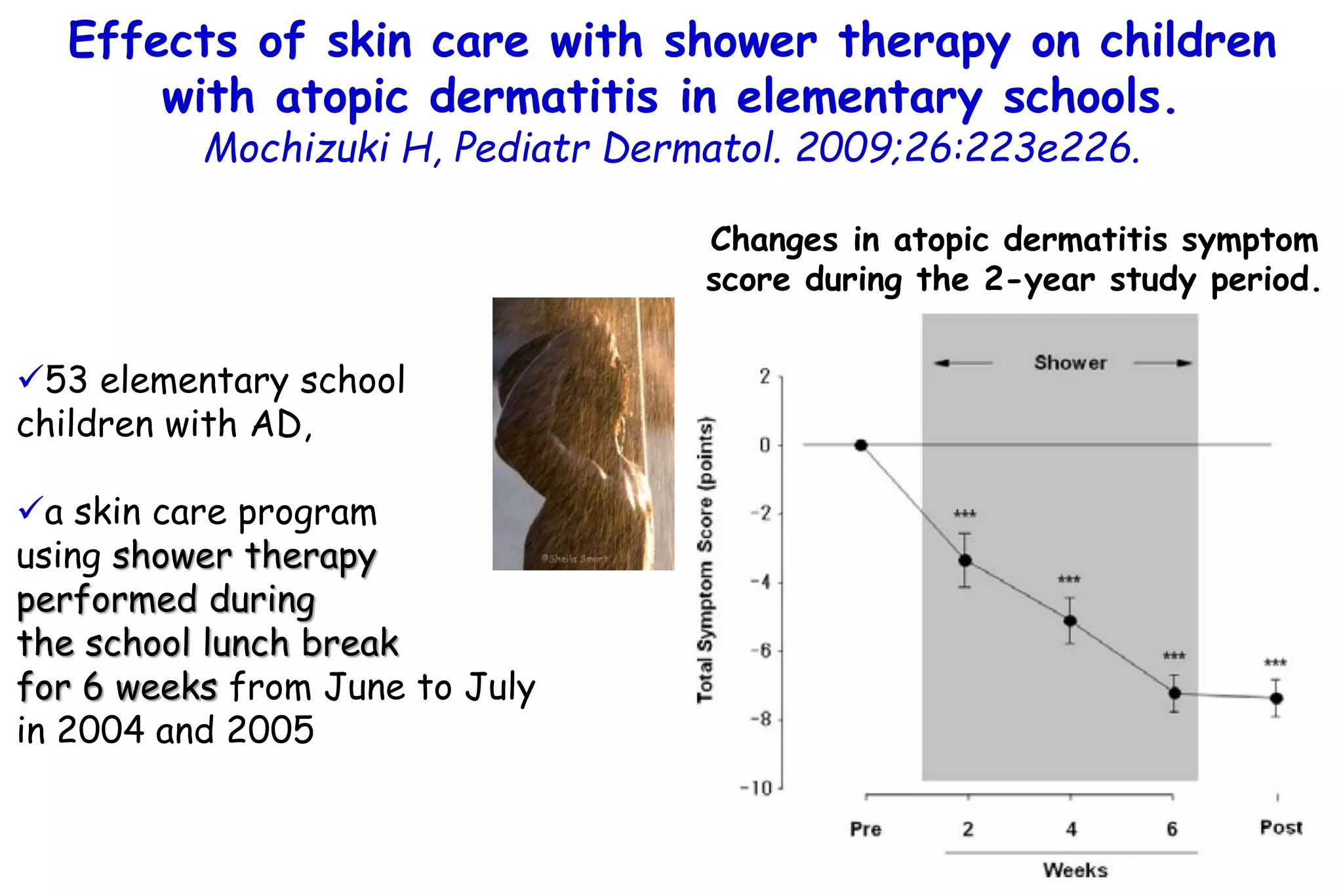 Bathing or not bathing in atopic dermatitis | PPTX