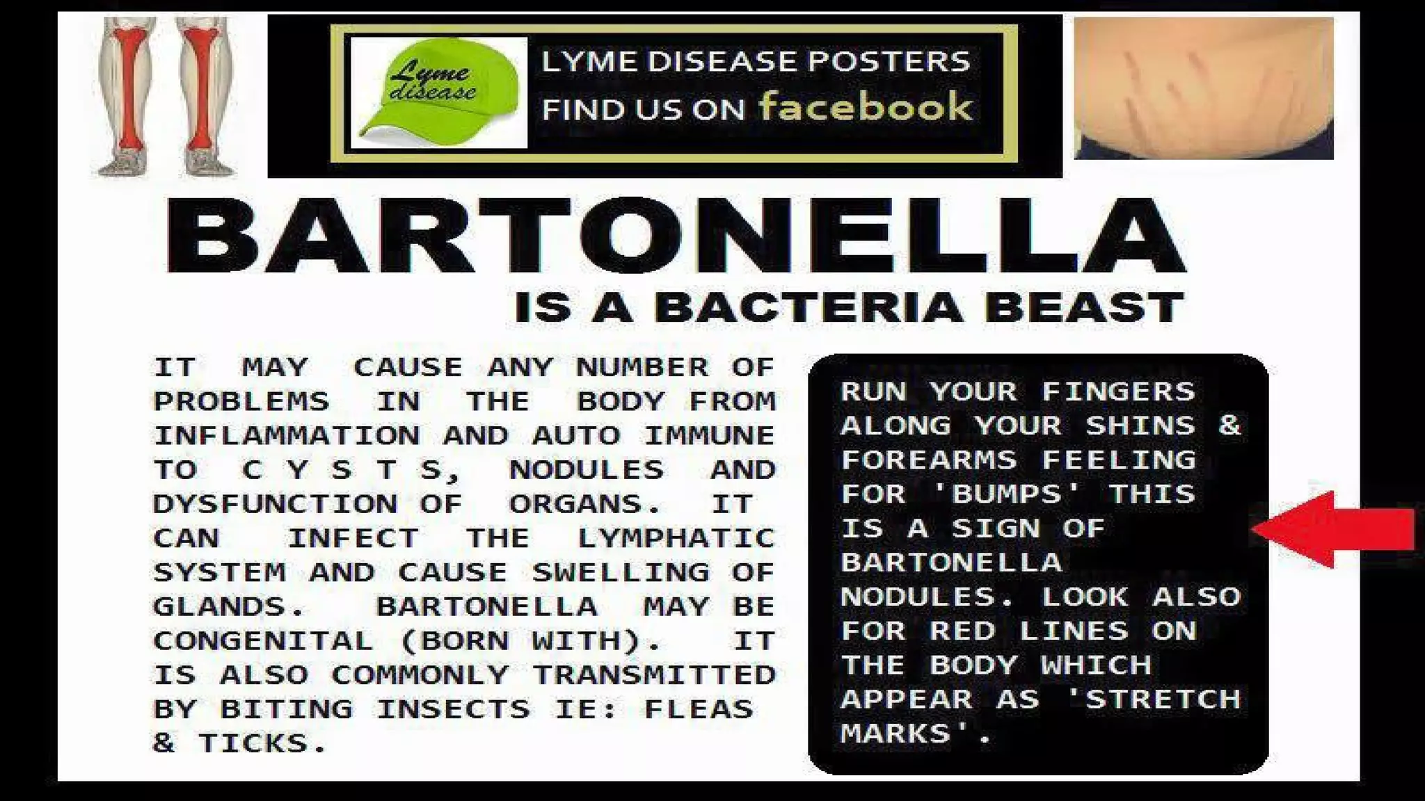 Bartonella | PDF