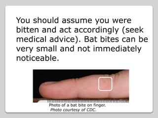 Bat Bite
