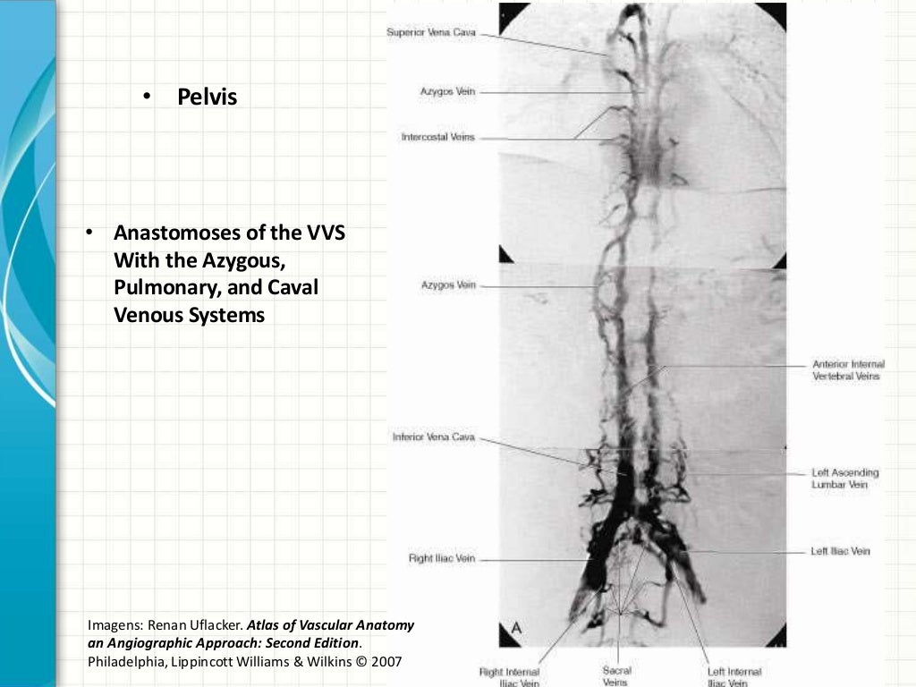 Plexo Venoso de Batson
