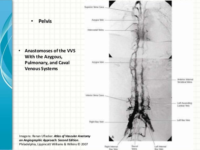 Plexo Venoso de Batson