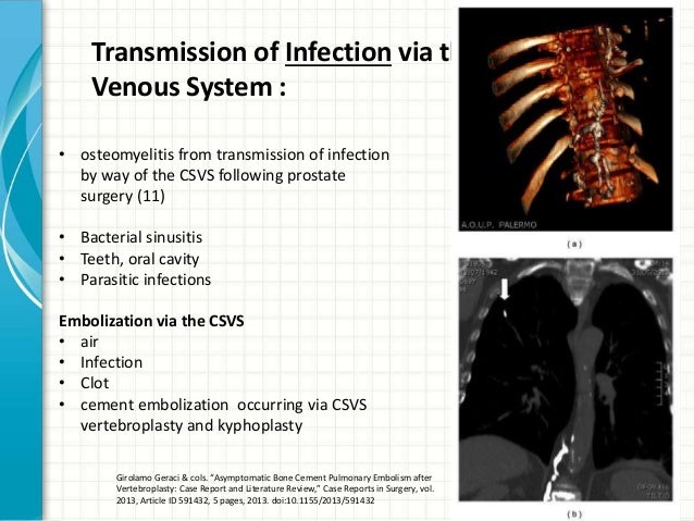 Plexo Venoso de Batson