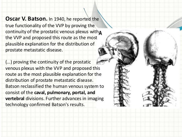Plexo Venoso de Batson