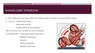 battered baby synd^.^.^^-1.pptx