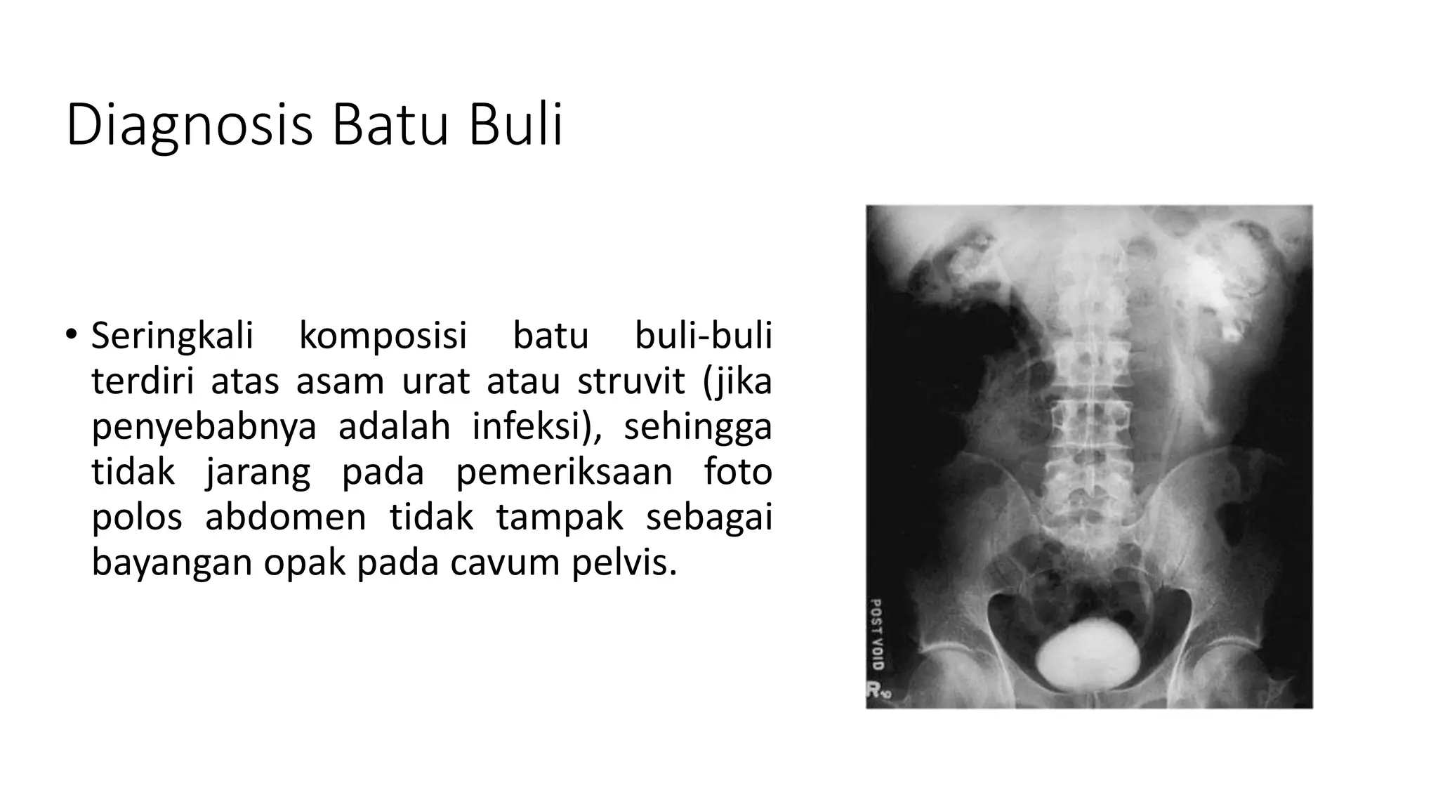 Batu Buli 06 Feb 2024 dalam manfaatnya bagi masyarakat.pptx