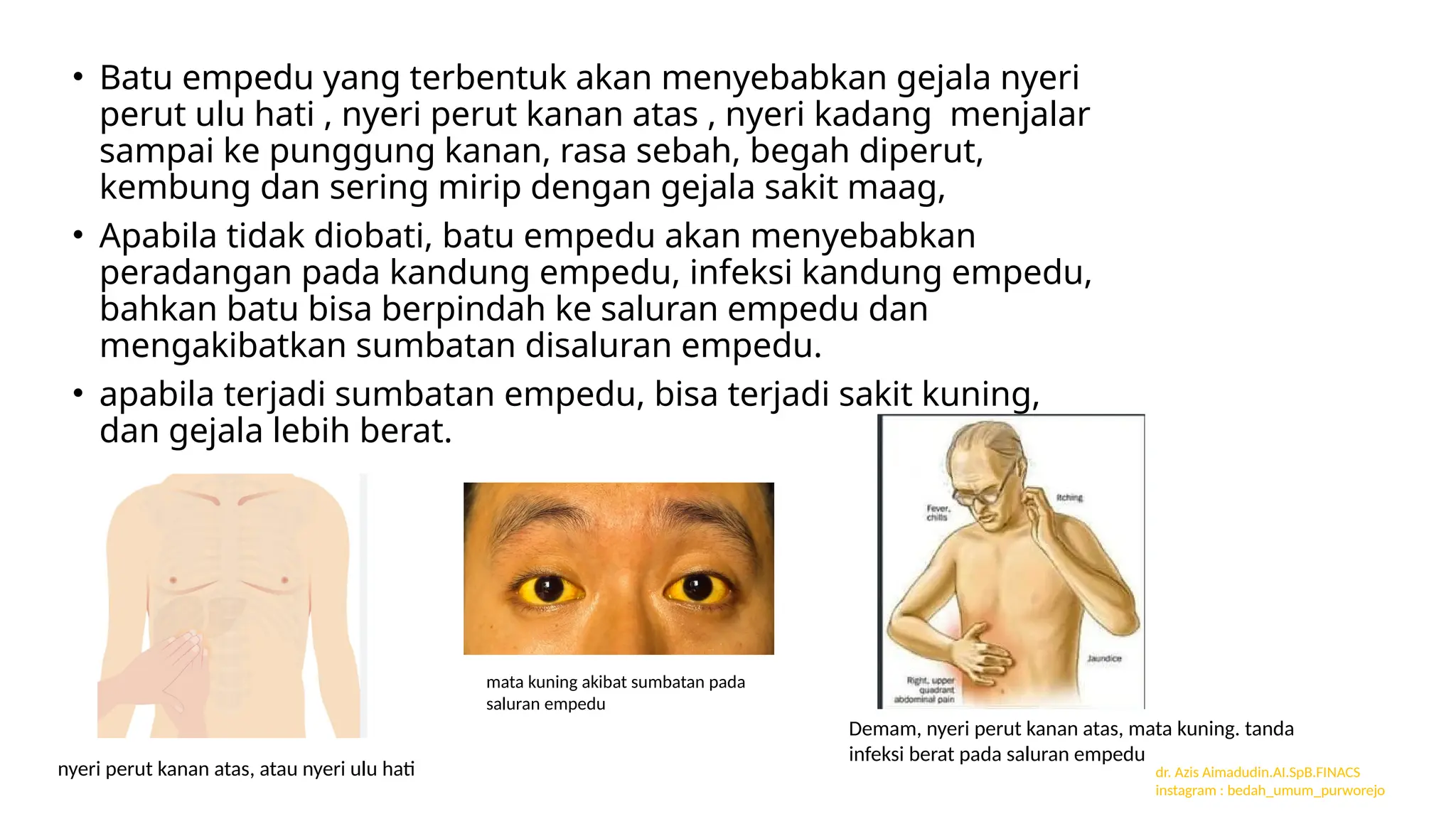 BATU EMPEDU cholelithiasis laparoscopy batu empedu | PPT