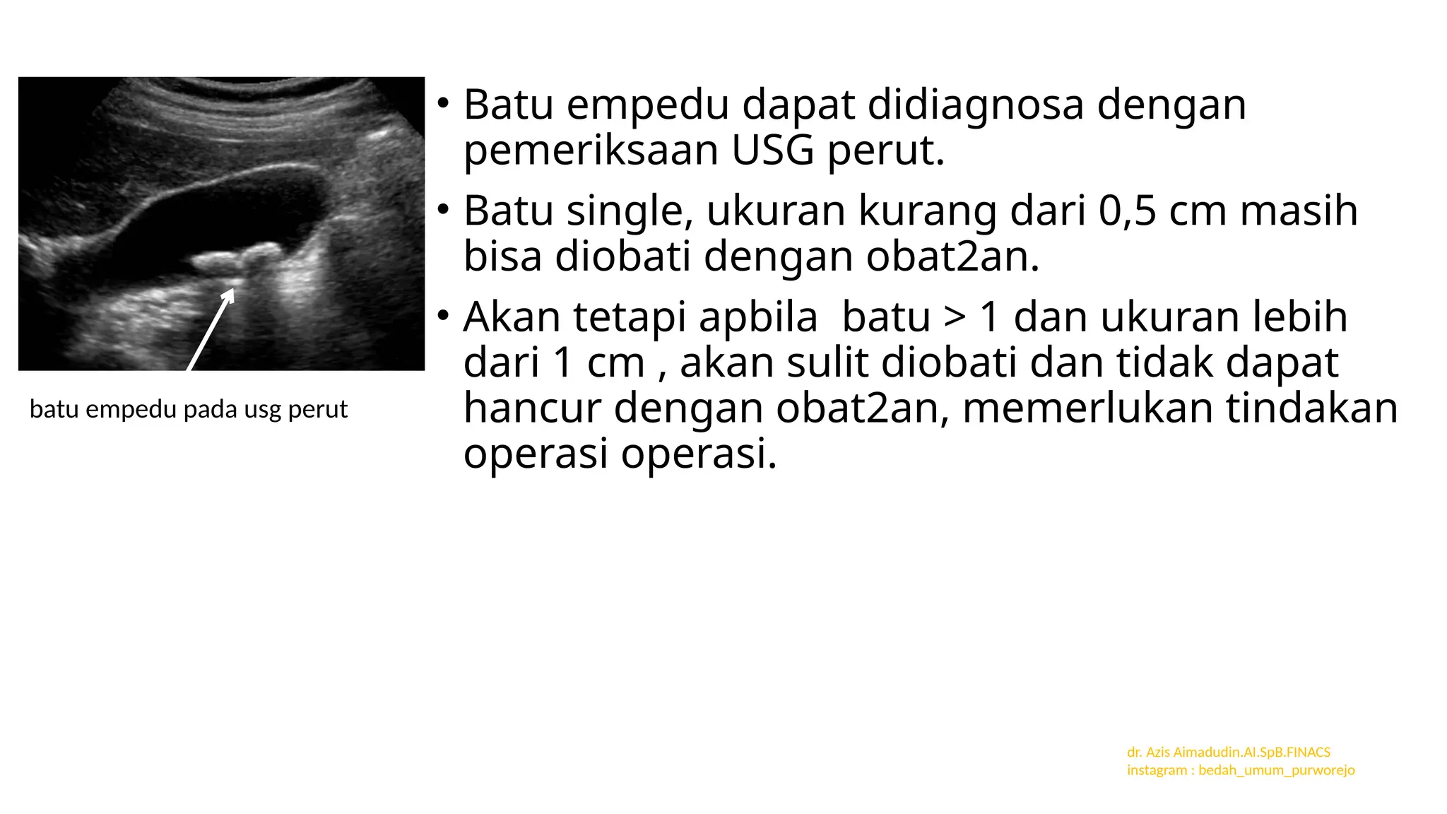 BATU EMPEDU cholelithiasis laparoscopy batu empedu | PPT